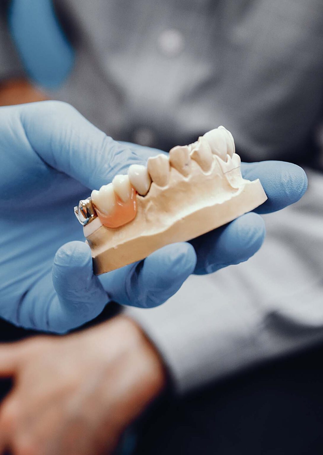 Kunstgebit – Tandzorglief